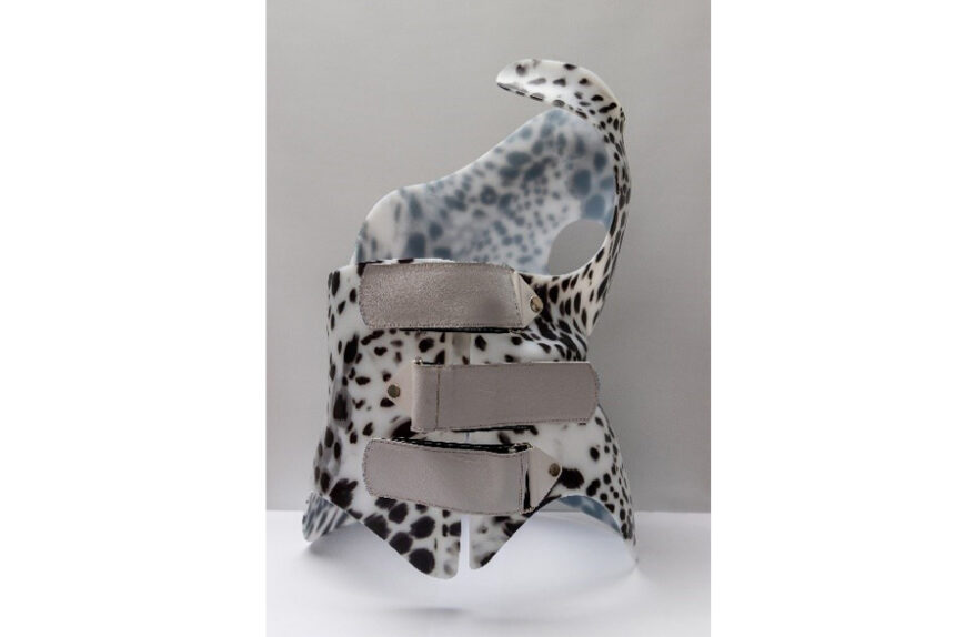 Ortoza za lakat i ručni zglob, zglobna, plastična - ORT ED PROTETIKA